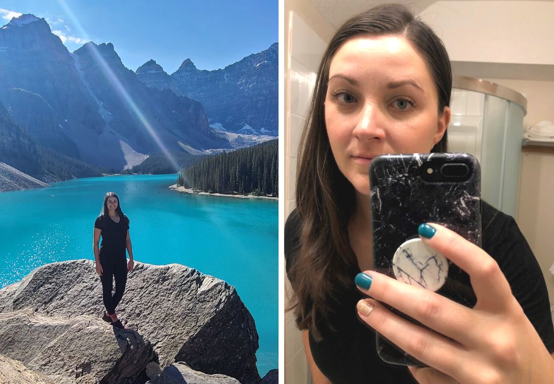 These Motion Sickness Patches Gave Me Wild Side Effects – Alison ...